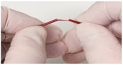 Experiment 8: Determination of Clotting Time by Capillary Glass Tube Method